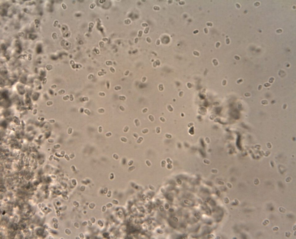 Costia (Ichtyobodo) – NVN